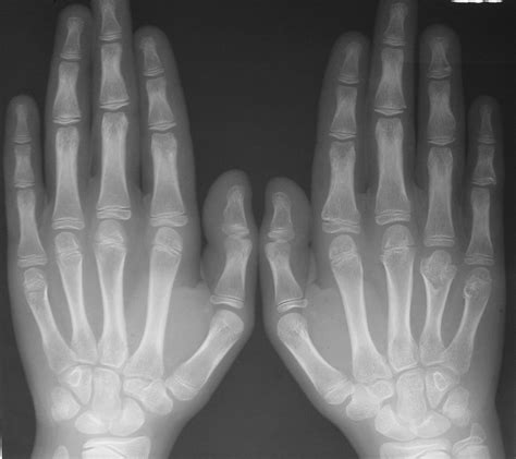 Ucsd Musculoskeletal Radiology