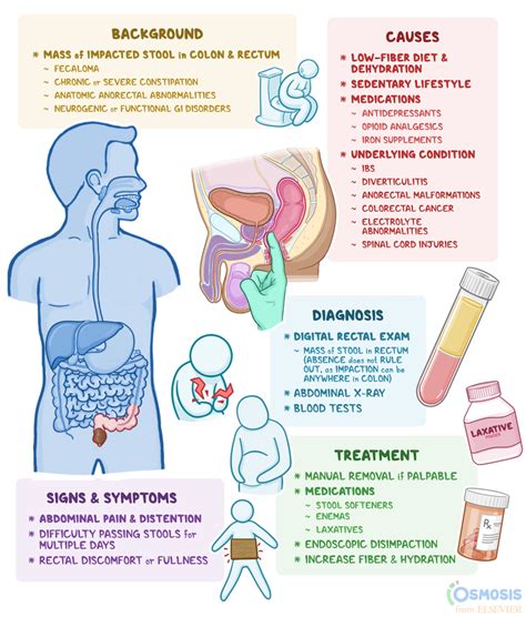 Fecal Impaction What Is It Causes Treatment And More Osmosis