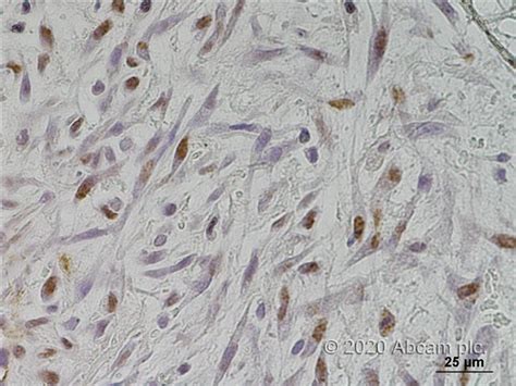 Rabbit Specific Hrp Dab Detection Ihc Detection Kit Micro Polymer Ab236469