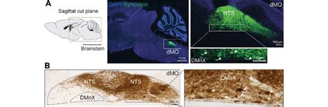 Targeted Overexpression Of Hα Synuclein In The Dorsal Medulla Download Scientific Diagram