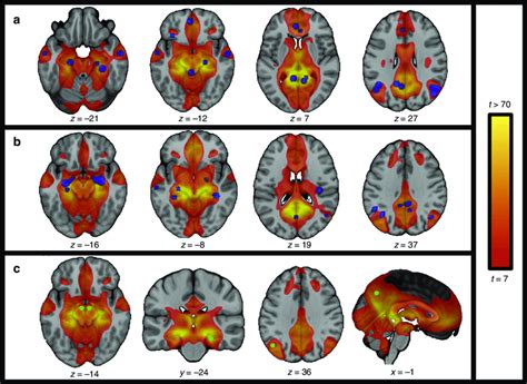 Memory Circuit Alignment With Other Imaging And Stimulation Modalities Download Scientific