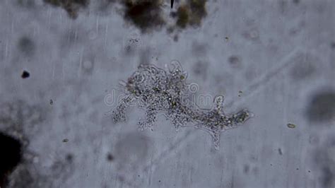 Amoebae Microbiology Under The Microscope Stock Footage Video Of Food Aquatic