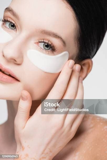 젊은 아름다운 여자 와 Vitiligo 과 눈 패치 에 고립 된 얼굴 에 흰색 20 24세에 대한 스톡 사진 및 기타 이미지