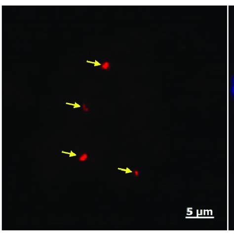 Localization Of 5s Rdna And 35s Rdna Probes On Root Tip Metaphase Download Scientific Diagram