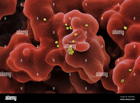 Las bacterias SARM color Micrografía análisis de electrones SEM