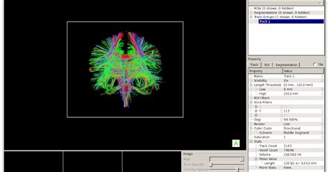 Dti Tutorial 3 Fiber Tractography Diffusion Imaging Introduction