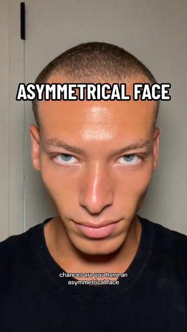 Best 12 How To Fix Asymmetrical Jaw Face TODAY Artofit