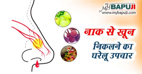 नाक से खून आने के कारण लक्षण घरेलू उपचार और दवा Naak Se Khoon