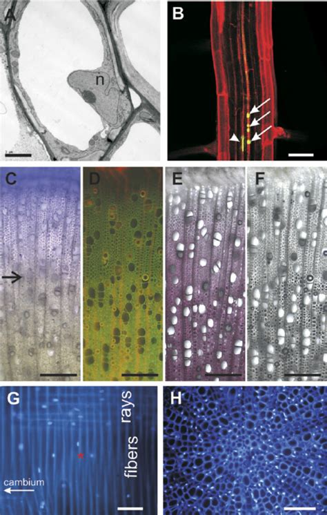Xylem Cell Under Microscope