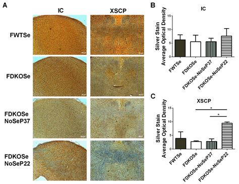 Disruption Of Selenium Handling During Puberty Causes Sex Specific