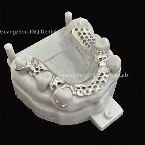 Digital Dentures Factory Removable Partial Dentures Metal Framework With Acrylic Teeth Good