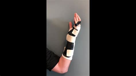 Hand Therapy Fellowship Roth Mcfarlane Hand And Upper Limb Centre