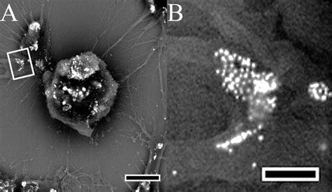 Advanced Characterization Techniques For Nanoparticles For Cancer Research Applications Of SEM