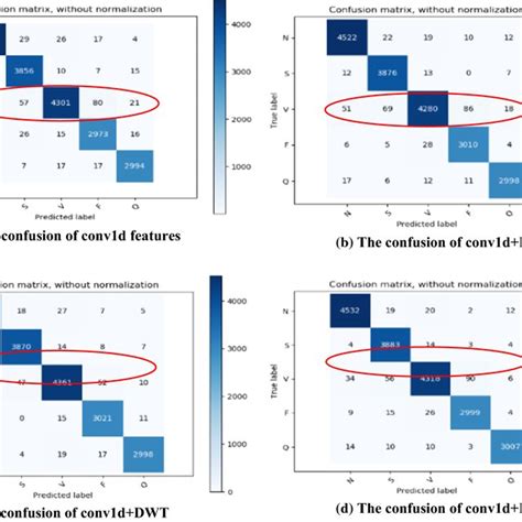 Ecg Arrhythmia Classification System Download Scientific Diagram