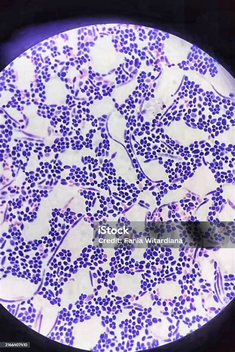 Branching Budding Yeast Cells With Pseudohyphae In Gram Stain Fine Under Light Microscope Stock