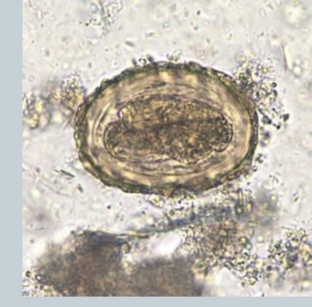 Parasitology Final Study Set Flashcards Quizlet