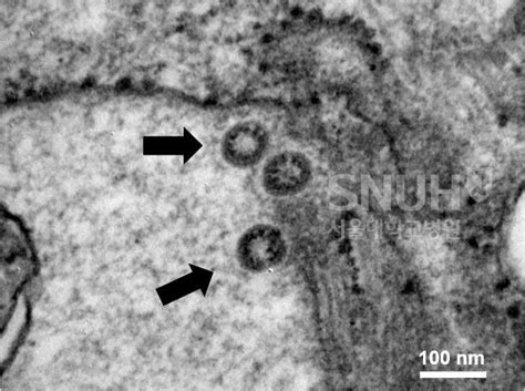 Actual Image Of Corona Virus Rcoronavirus