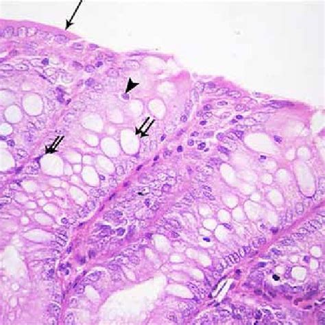 Photomicrograph Of A Section Of The Distal Colon Of A Rat Showing