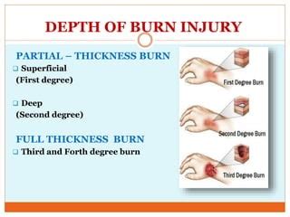 Burn Pptx