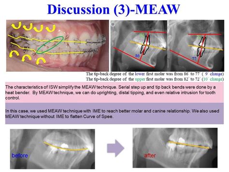 Facial Asymmetry Correction Download Scientific Diagram