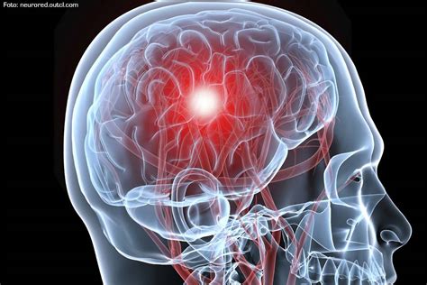 Es verdad que usamos sólo el 10 de nuestro cerebro Un mito clásico