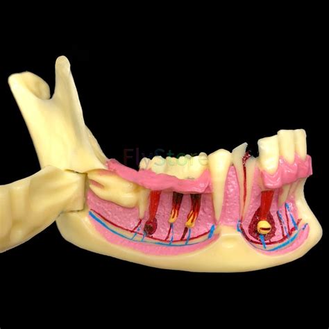 Dental Mandibular Teaching Model Teeth Demonstrati Grandado