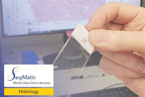 Histopathology Tissue Processing Services Seqmatic