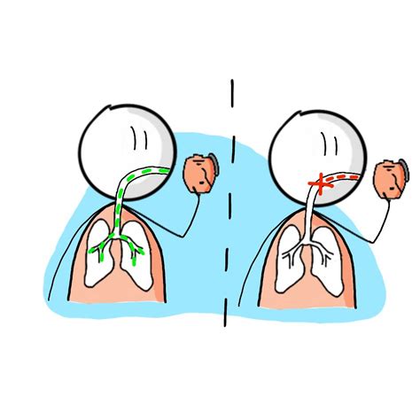 Nrs Science On Linkedin Does Mixing Inhaler Technique Devices Lead To