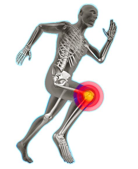 Knee Cartilage Diagnosis And Treatment Cartilage Transplant Knee