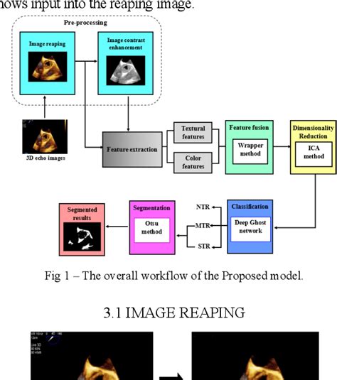 Figure 2 From Fetal 3d Echo Classification And Segmentation Using Color And Textural Features Figure 2 From Fetal 3d Echo Classification And Segmentation Using Color And Textural Features