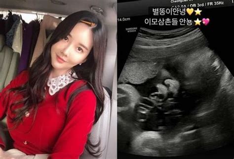 임신 장미인애 출산 앞두고 2세 초음파 공개이모 삼촌들 안뇽 Zum 뉴스