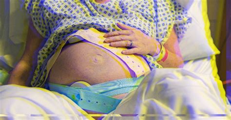 Obstetric Violence Women Tell Of Their Experiences