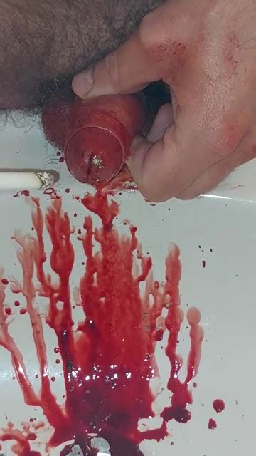 Burning My Cock With Cigarette After Needling 日本語で