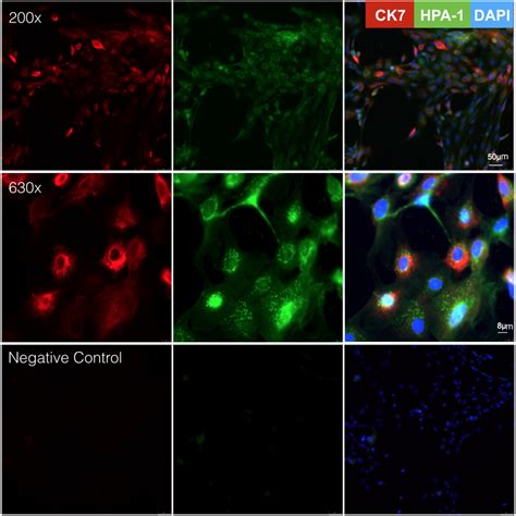In Vitro Method To Study Sex Based Differences In Conjunctival Goblet Cells