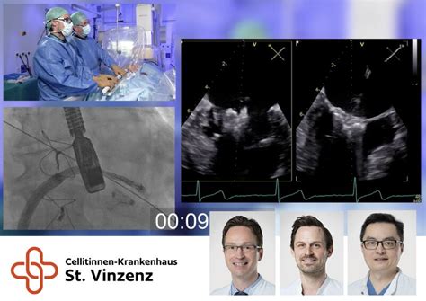 Teer Pascal Precision Edwardslifesciences Edwardslifesciences Edwardslifesciences Teer