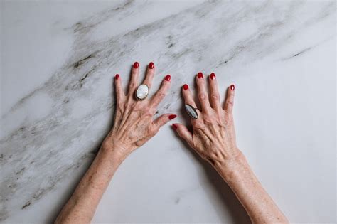 Skin Tears 10 Tips And Tricks On How To Prevent And Treat