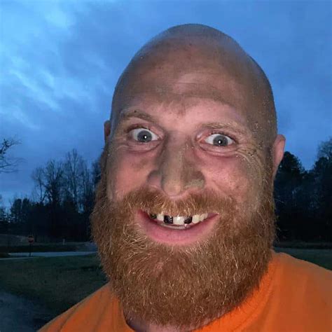 From Respiratory Therapist To Comedian About Ginger Billy His Wife And Net Worth