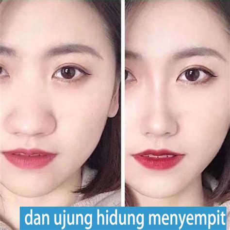 Hasil Cepat Hidung Cantik Hidung Menjadi Kecil Batang Hidung Menjadi