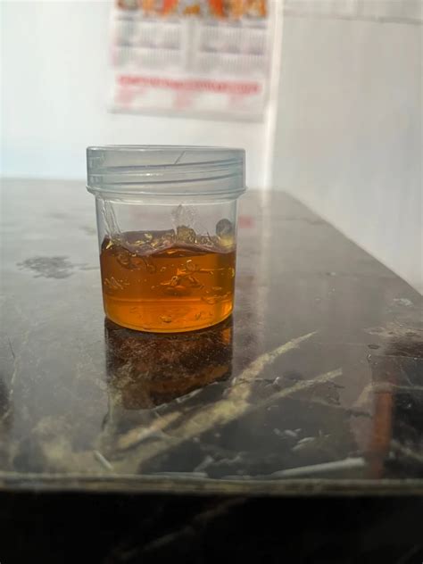 Sexual Oil 30 Ml Bottle At Rs 4000bottle In Hoshiarpur Id
