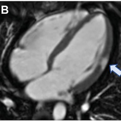 Initial Cardiac Magnetic Resonance Images On Presentation Download Scientific Diagram