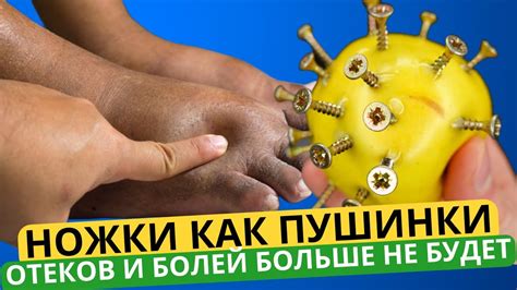 Ноги как пушинки и не болят Кости суставы связки сухожилия боль в