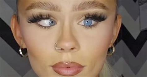 Model Trolled For Lazy Eye Transforms After Undergoing Corrective Surgery Daily Star