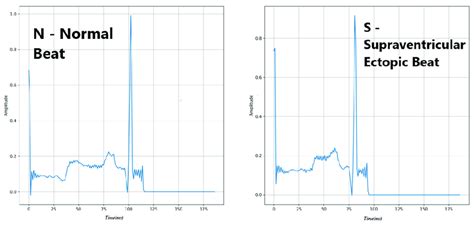 Extracted QRS Complex Of Heartbeats Furthermore The Original Dataset Download Scientific