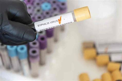 Vdrl False Positive Test What Are The Causes Of This