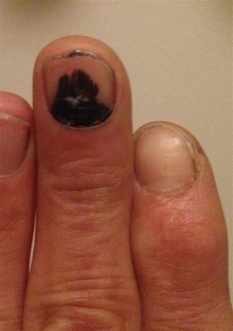 Chisel Handguard Suggestions Electrician Talk