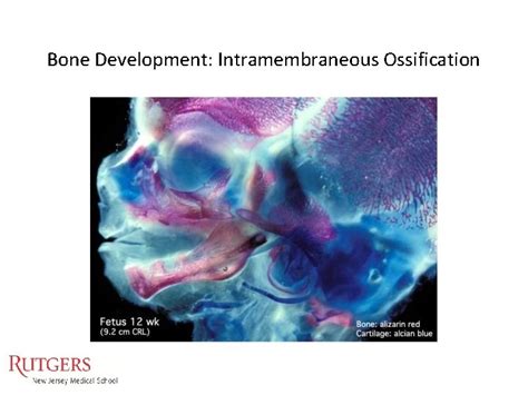 Lecture 49 Bone Physiology Resorption And Formation Pat