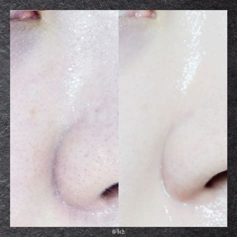블랙헤드 오일투폼 클렌저 스킵케어 네이버 블로그