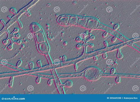 Fungus Trichophyton Tonsurans 3d Illustration Stock Illustration