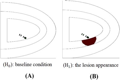 Models Used In Distinguishability Test Z Score Calculation The Case Download Scientific