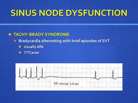 Ppt Heart Blocks And Cardiac Pacemakers Powerpoint Presentation Free Download Id2244626